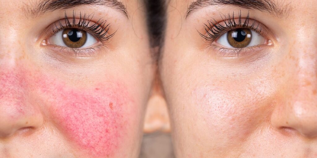 5 Dermatologist-Approved Treatments For Sun-Damaged Skin | Feinstein ...